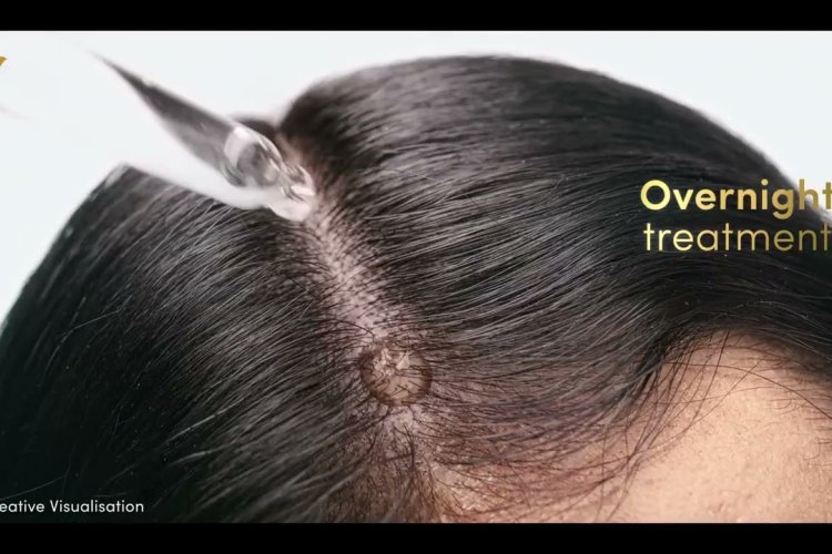Dove Launches ‘Change Hair Density, Change Hair Destiny’ Campaign - Home